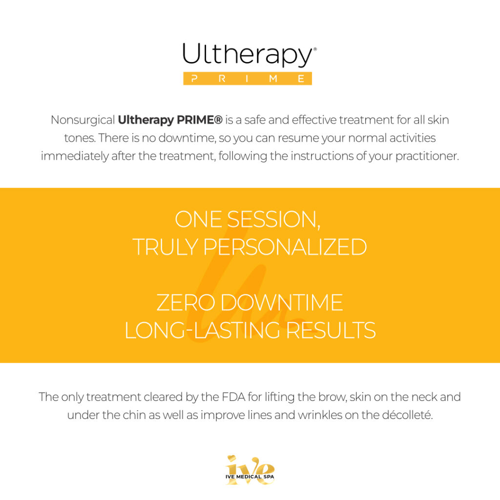 Ultherapy PRIME, Nonsurgical Lift - IVE MEDICAL SPA | 아이브 메디칼 스파 LA 한인 ...